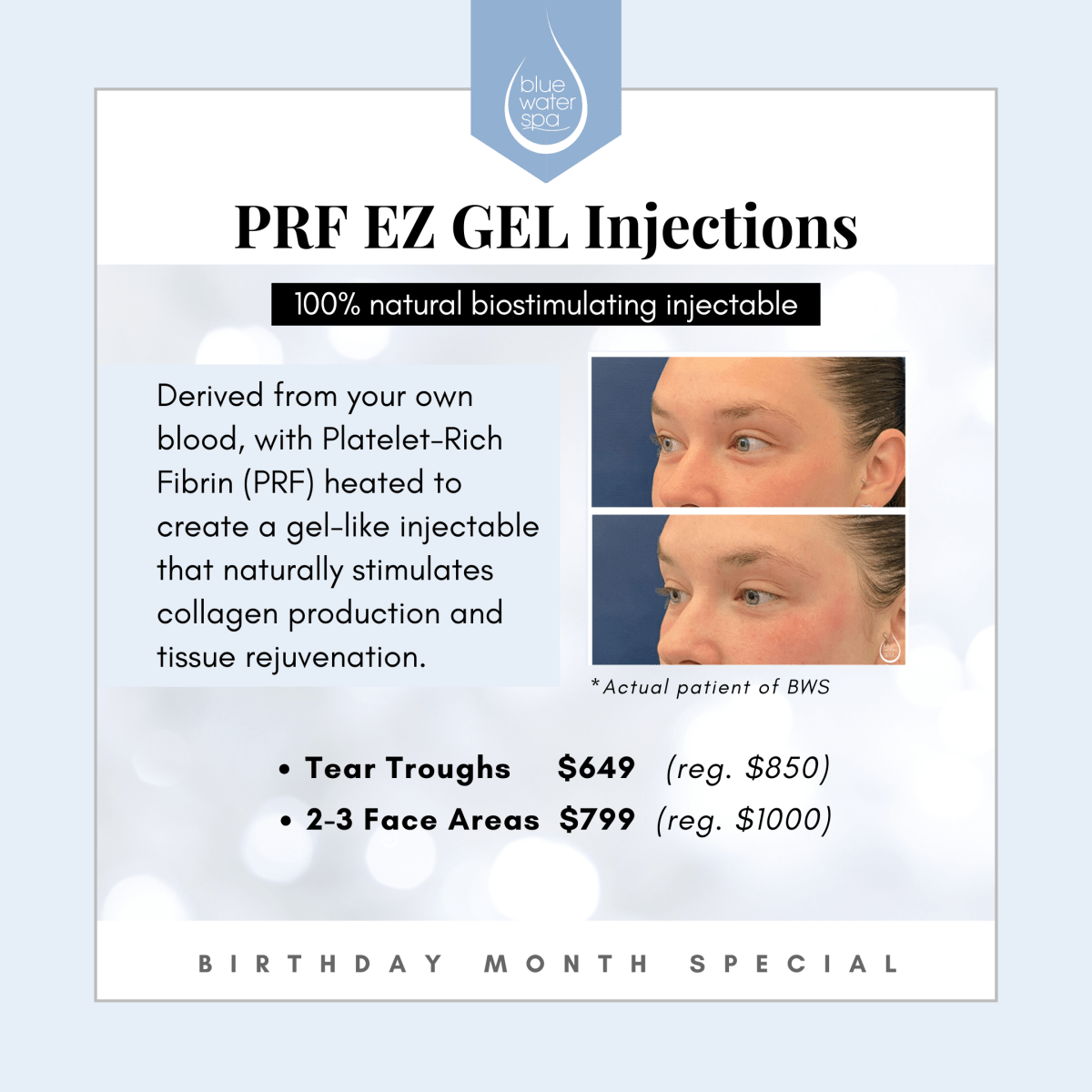 PRF EZ Gel Skin Rejuvenation | PRP Injections at Blue Water Spa