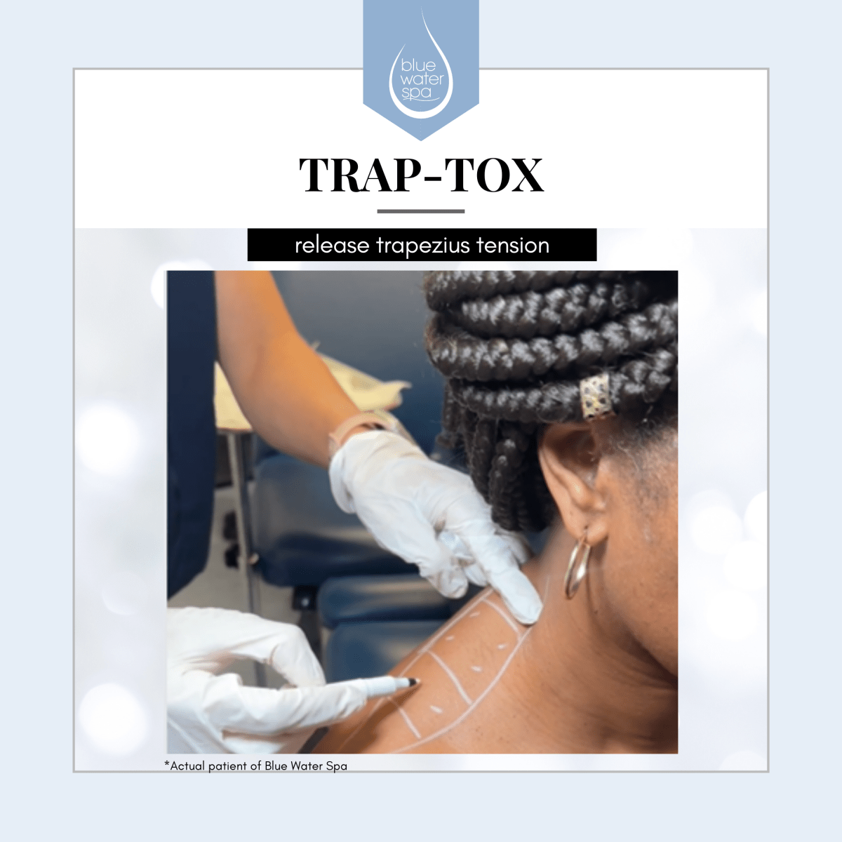 Botox® Treatments for Trapezius Muscles | Blue Water Spa in Raleigh, NC